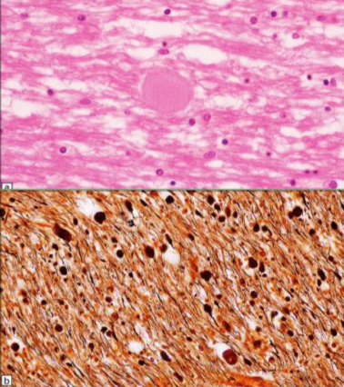 Neuro-Histology Flashcards | Memorang
