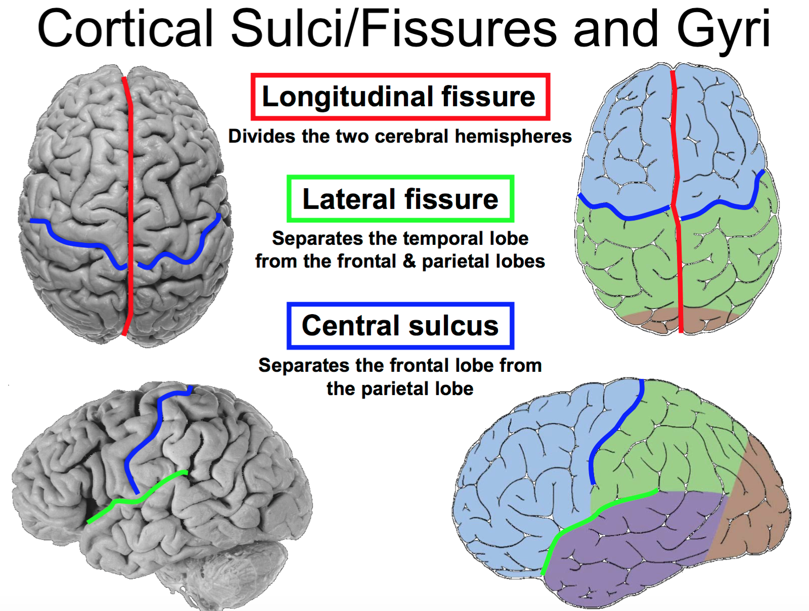 Central Fissure Separates Which Lobes