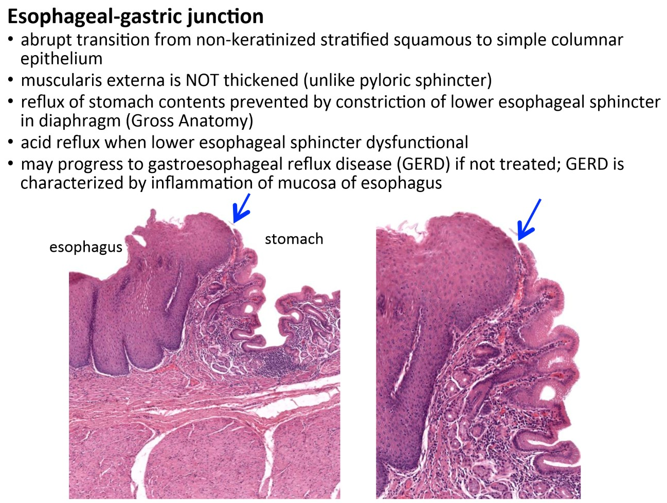 Gastroesophageal Junction Slide Labeled