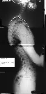 Structures Flashcards | Memorang