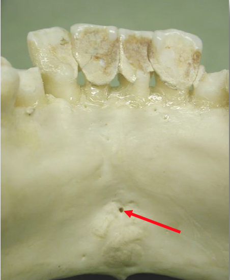 Lingual Foramen And Genial Tubercle