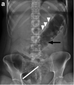 Abdomen Flashcards | Memorang