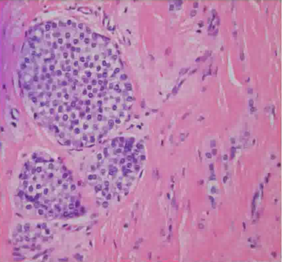 Histo Flashcards | Memorang