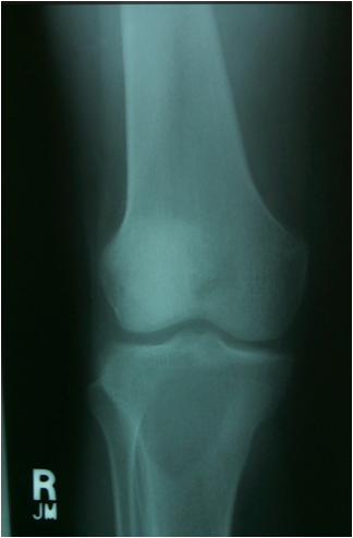 Radiology Flashcards | Memorang