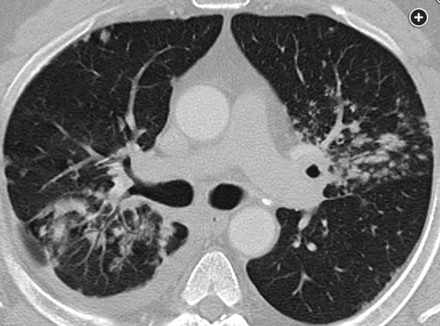 Imaging Flashcards | Memorang