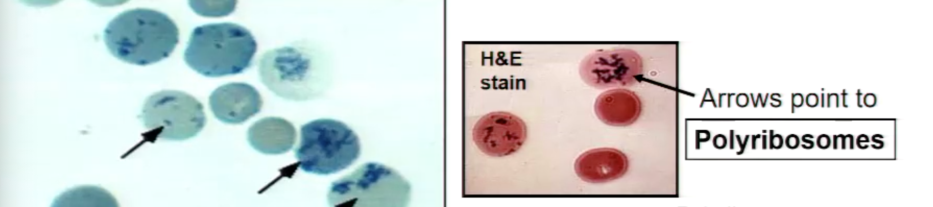 Hemoglobin Flashcards | Memorang