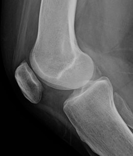 Radiology Flashcards | Memorang