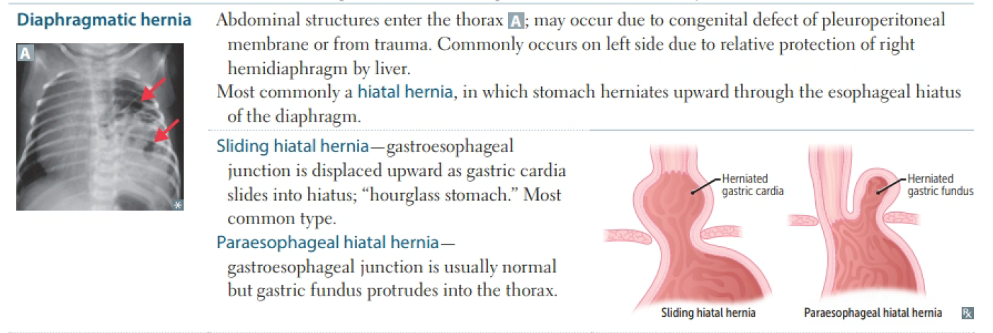 5.7 Flashcards | Memorang