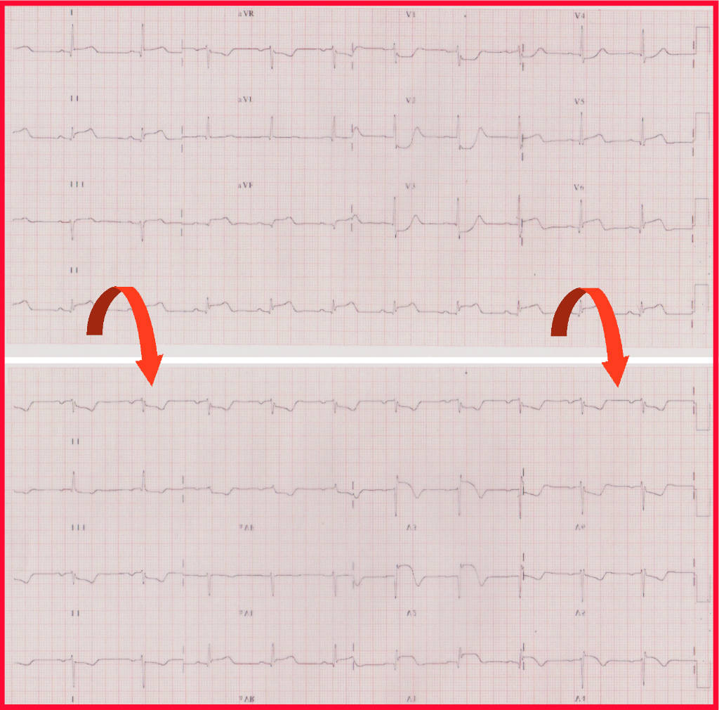 Visual Diagnosis: EKGs Flashcards | Memorang