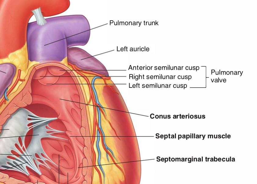 Conus Arteriosus Heart