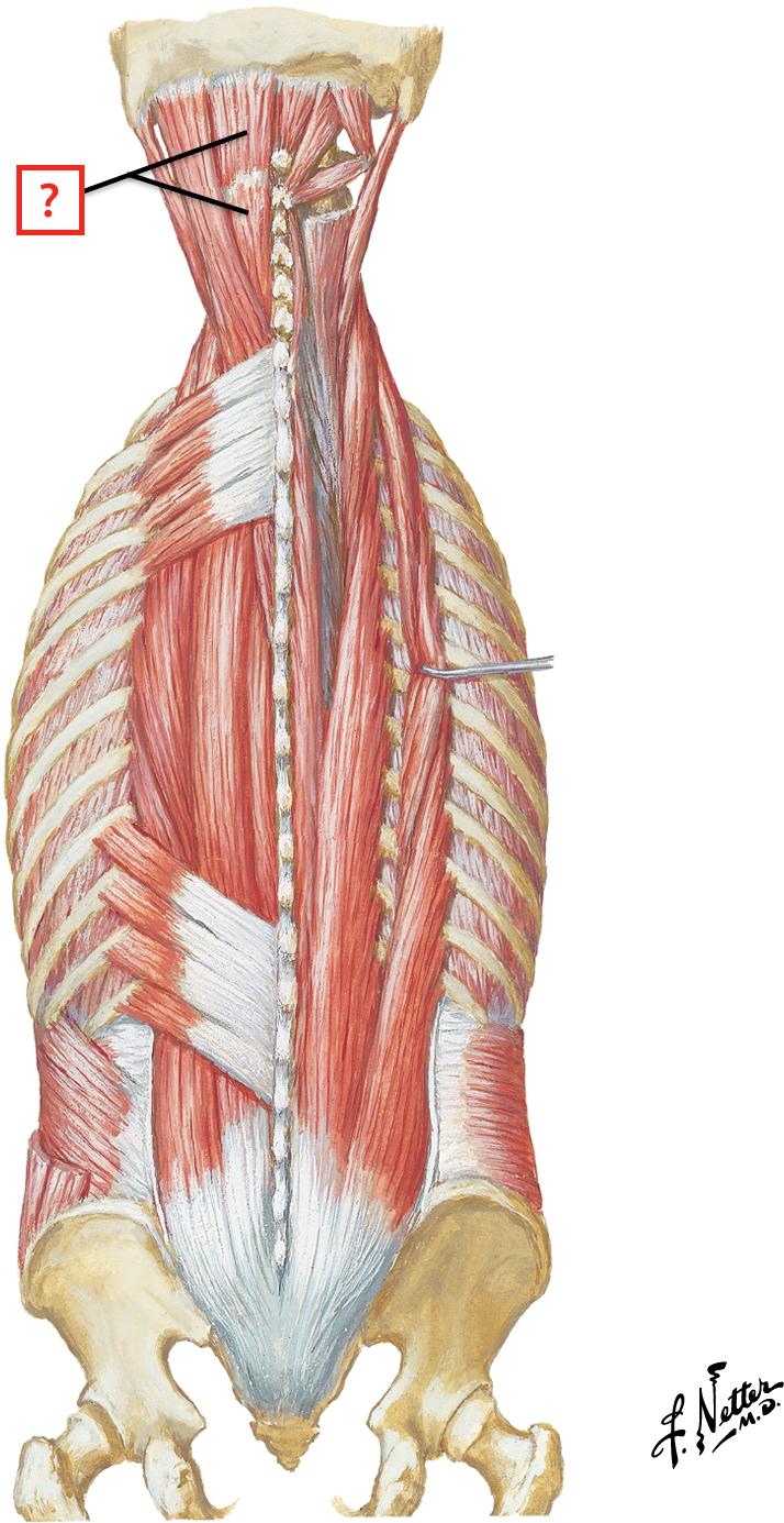 Intrinsic And Extrinsic Muscles Spine