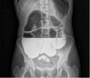 Abdomen Flashcards | Memorang