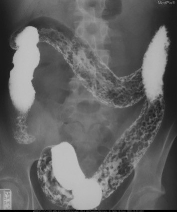 Abdomen Flashcards | Memorang
