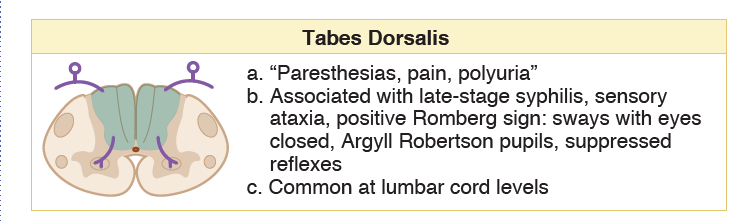 Tabes Dorsalis Spinal Cord