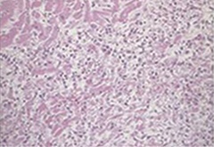 Learning Set Flashcards | Memorang