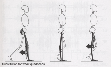 Gait Flashcards | Memorang