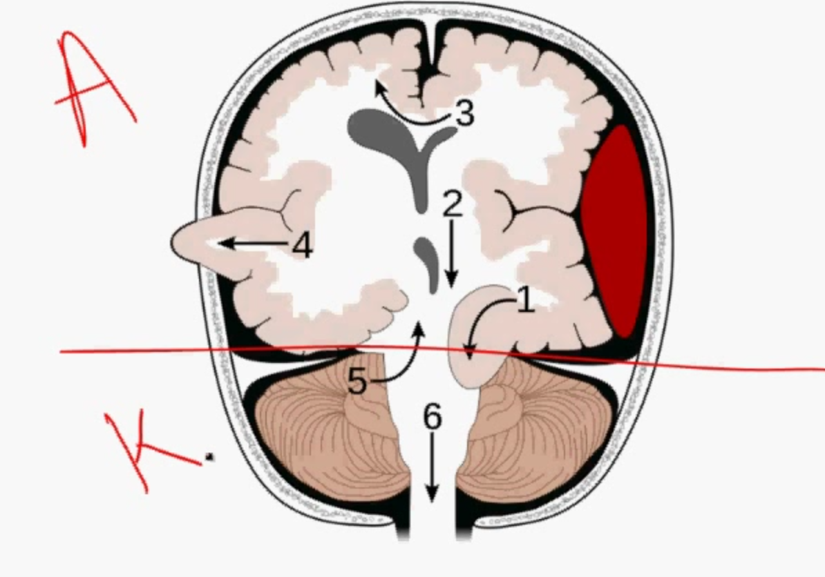 Neuro2 Flashcards | Memorang