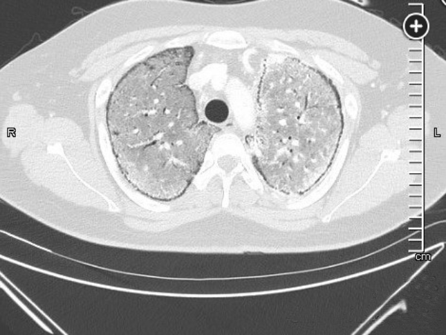 Imaging Flashcards | Memorang