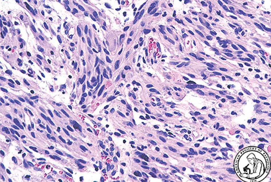 PXA Flashcards | Memorang