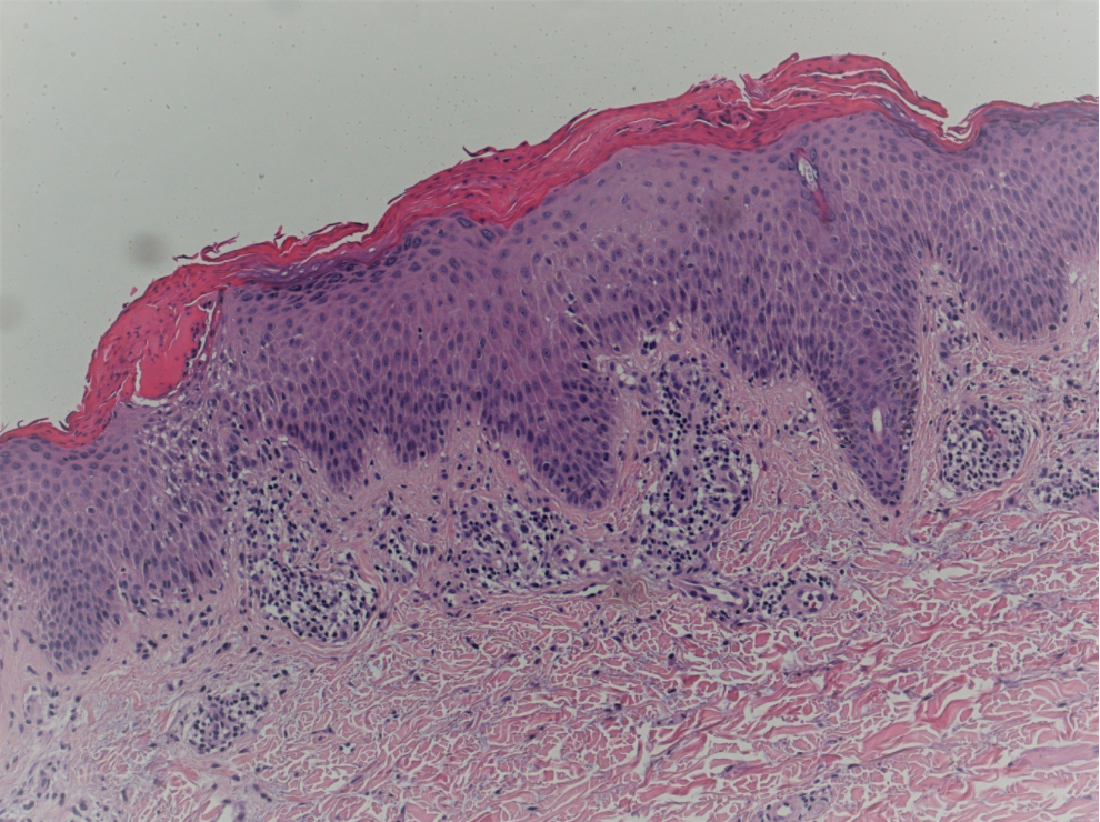 Basic Exam Flashcards | Memorang