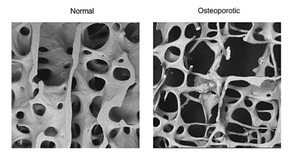 Endo Flashcards | Memorang