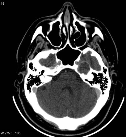 CORE Flashcards | Memorang