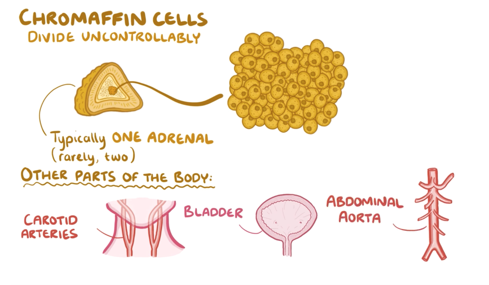 Pheochromocytoma Flashcards | Memorang