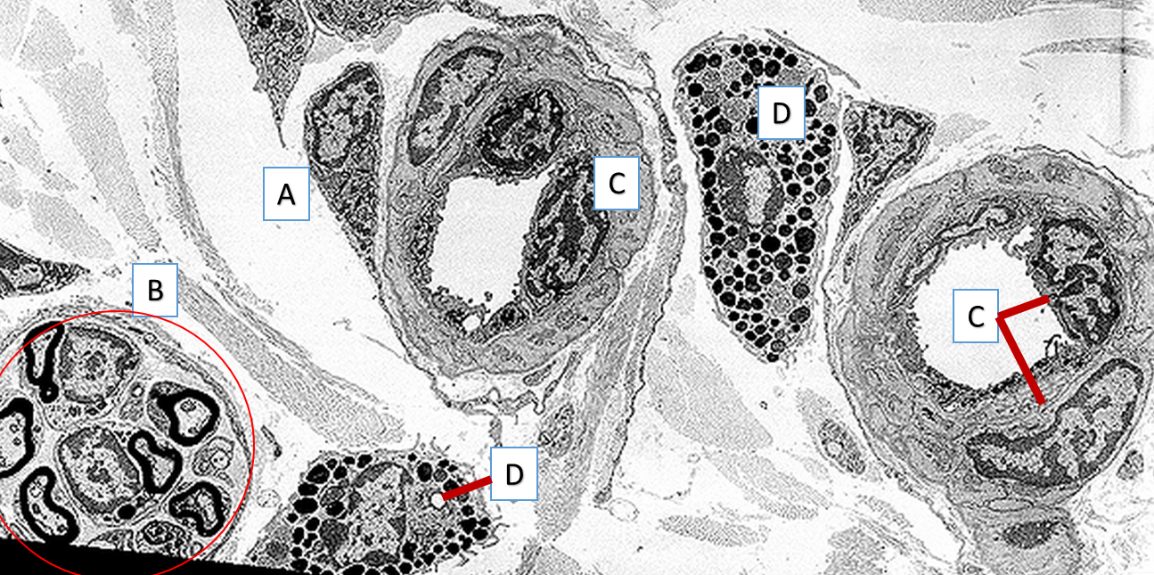 Neurons Flashcards | Memorang