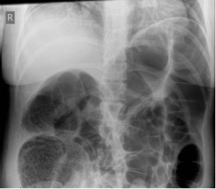 Abdomen Flashcards | Memorang