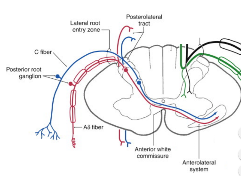 Anterior White Commissure