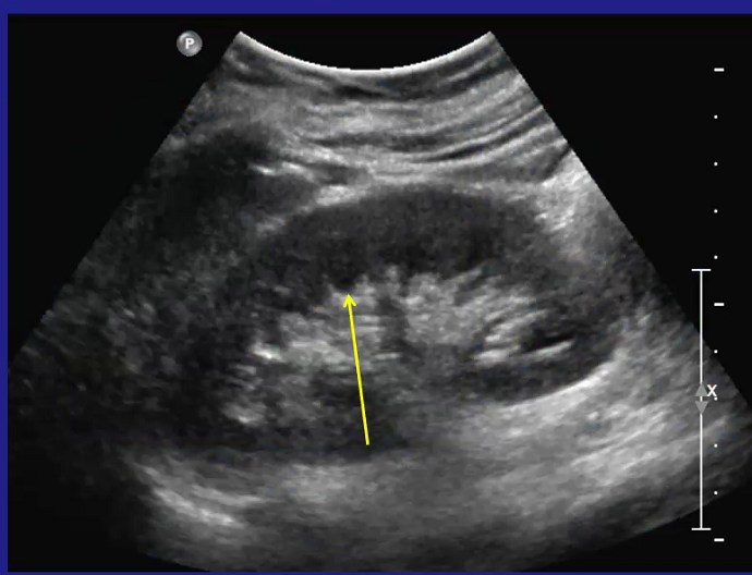 Radiology Flashcards | Memorang