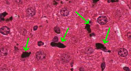 Pathology Outlines Histology