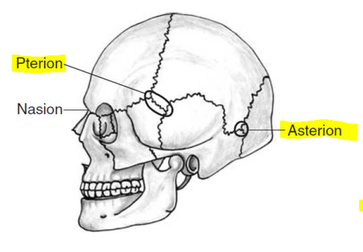 Asterion Skull