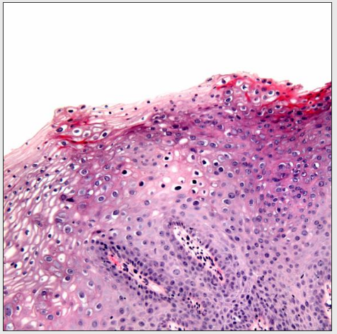 Cervix Flashcards | Memorang