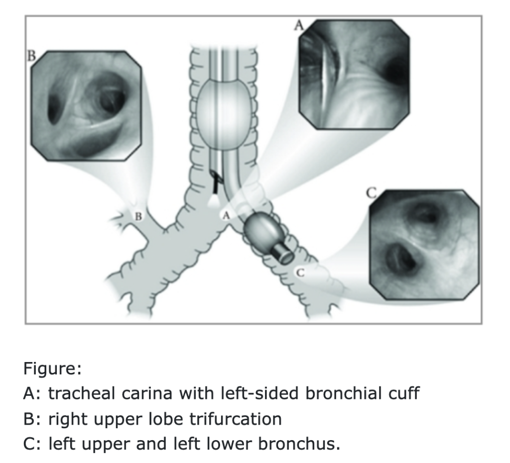 True Learn set 12 Flashcards | Memorang