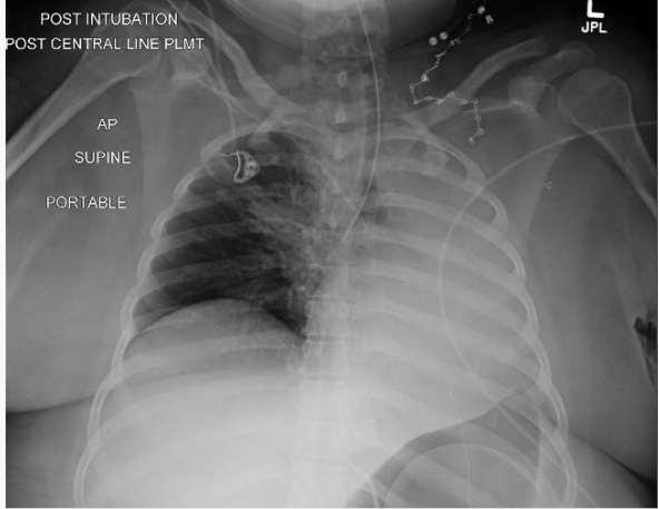 Imaging Flashcards | Memorang