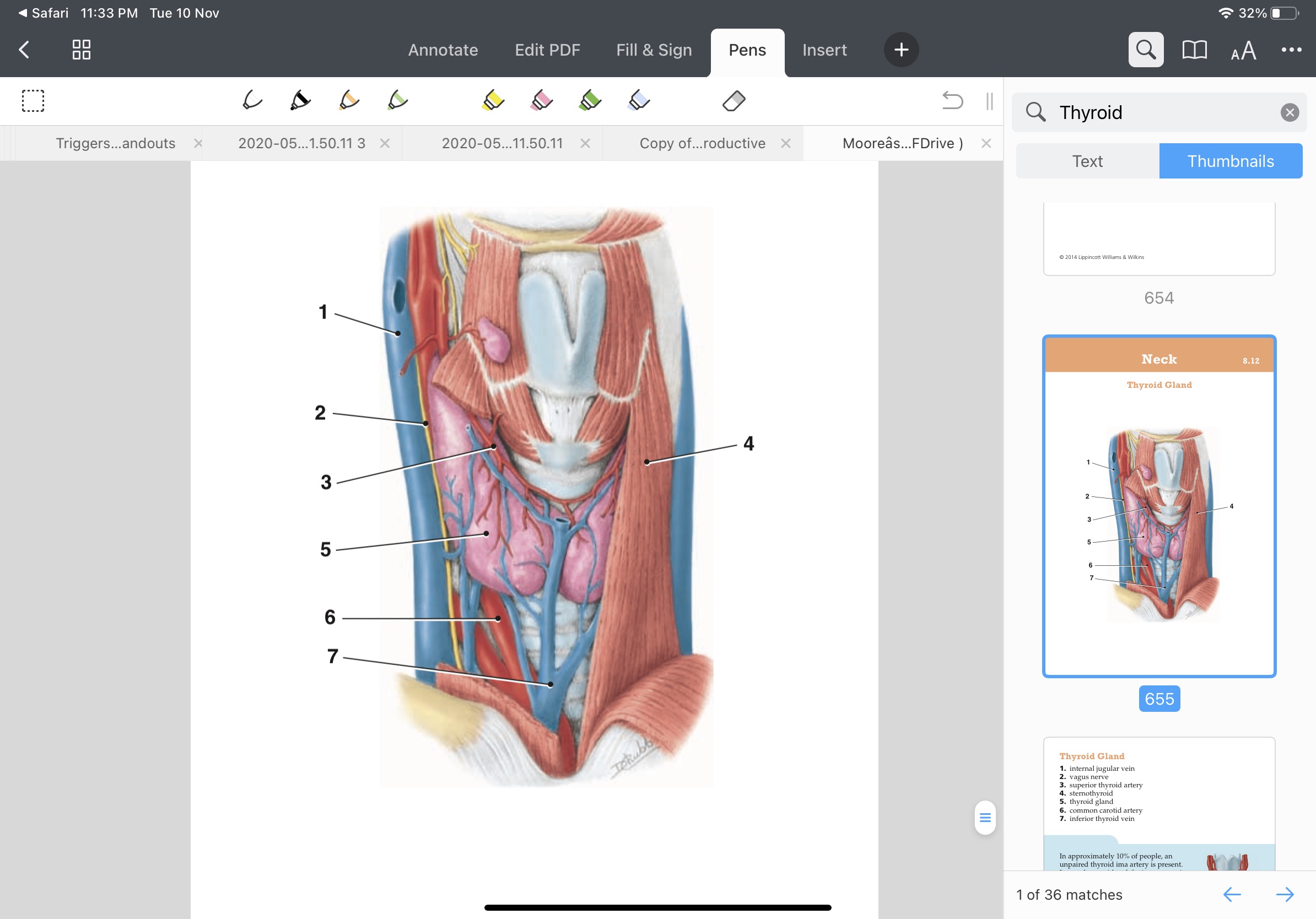 Ggg Flashcards | Memorang