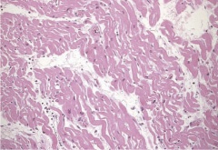 Learning Set Flashcards | Memorang