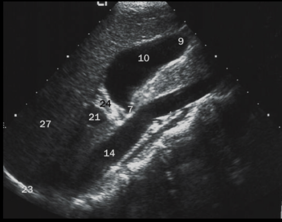 C7T3L08-09 Abdominal Imaging I and II Flashcards | Memorang
