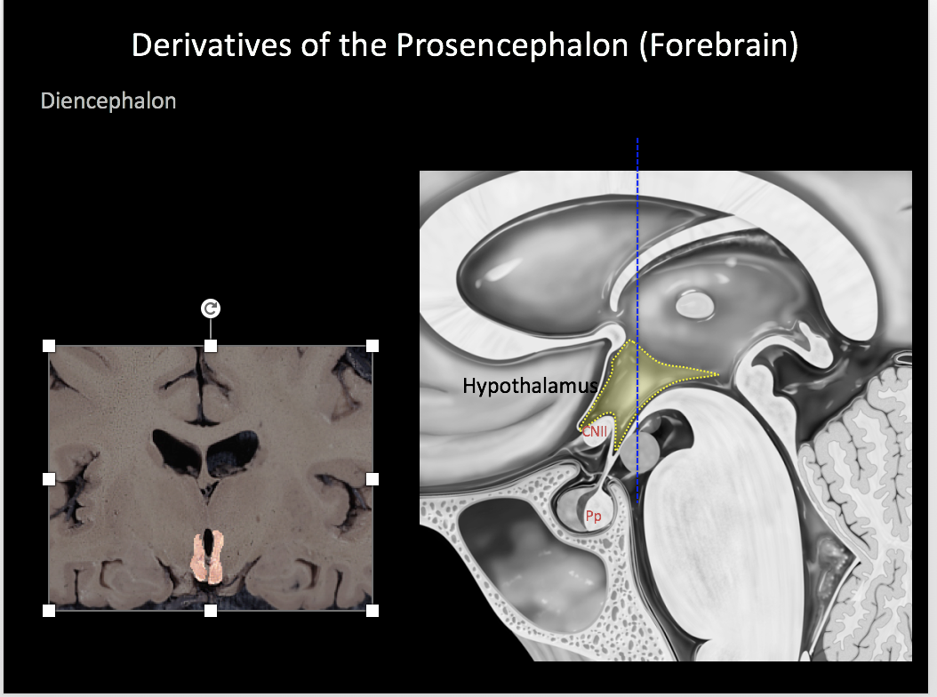 Forebrain Flashcards | Memorang