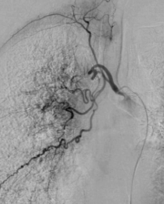 Body Angiography Flashcards | Memorang