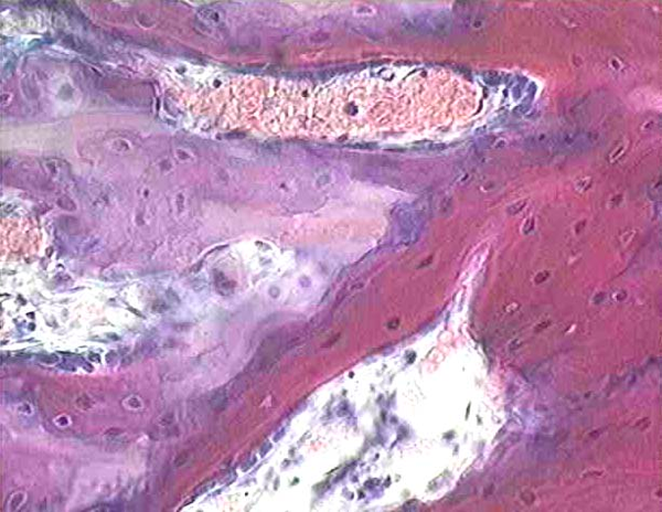 Bone Flashcards | Memorang