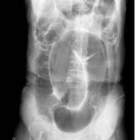 Abdomen Flashcards | Memorang