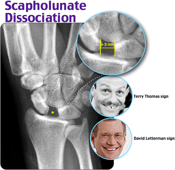 EM Stack 3 Flashcards | Memorang