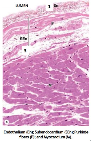 Subendocardial Layer
