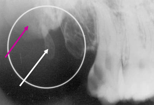 D2.Radiology.II.Anatomy Flashcards | Memorang
