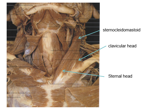 Infrahyoid Muscles Cadaver Axial Muscles Of The Head, Neck, And Back