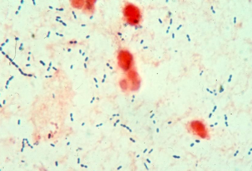 BLHD Microbiology Final Flashcards | Memorang