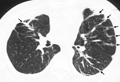 Imaging Flashcards | Memorang