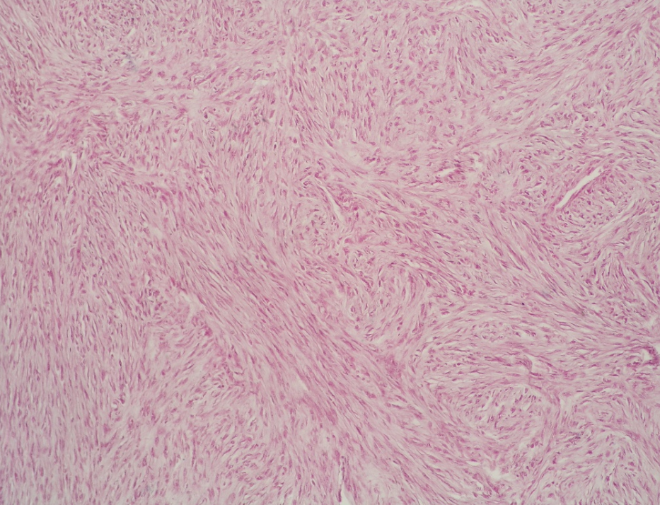 upr 11 Flashcards | Memorang